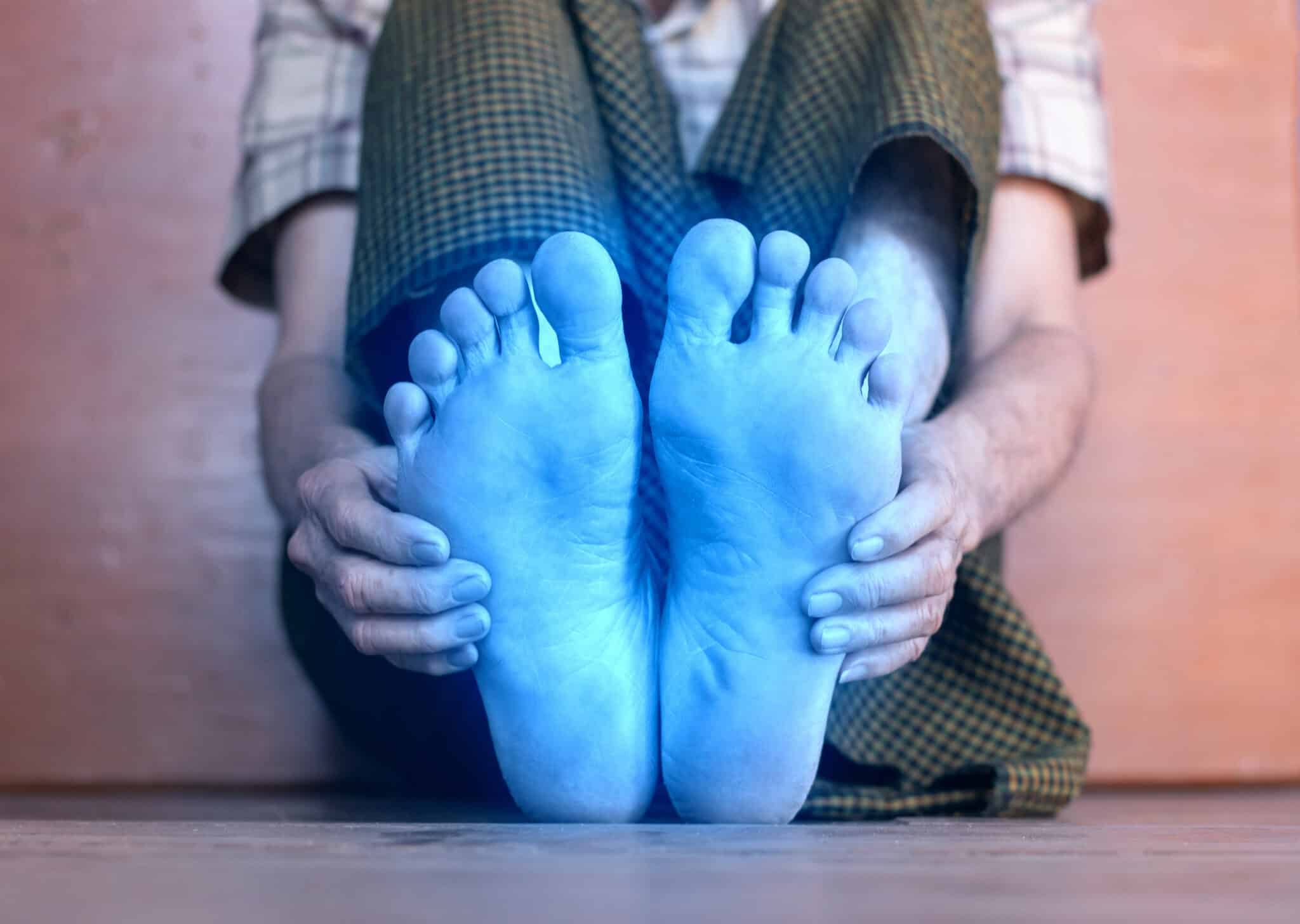 Cold Foot/Toes, Rest Pain or Color Change