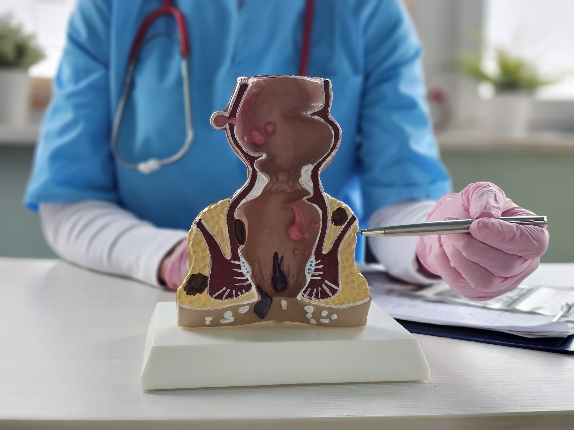 Rectal Bleeding & Hemorrhoid Symptoms in St. Louis, MO